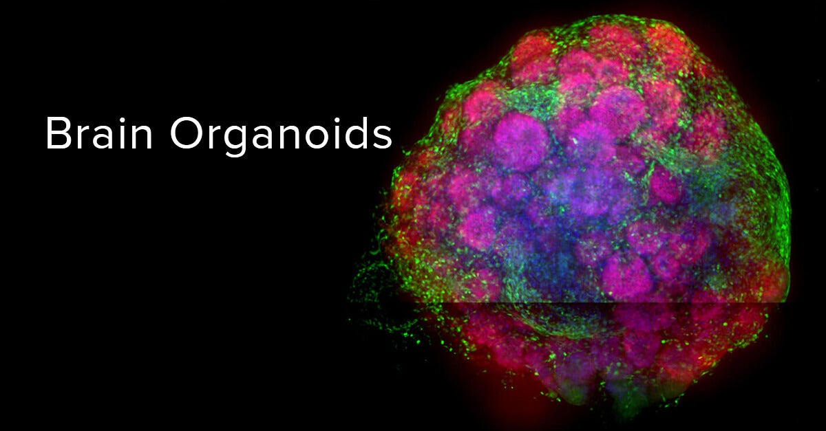 Brain Organoids, Cerebral Organoids Development | Molecular Devices