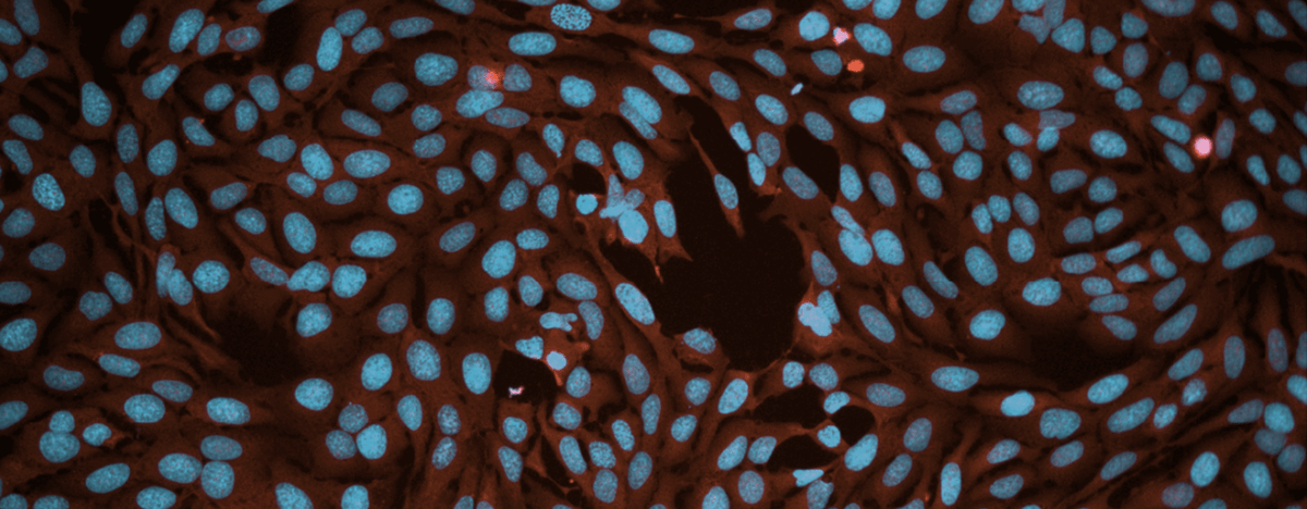 Animal Skin Cells Under Microscope