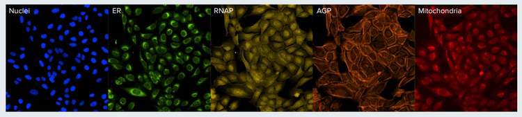 Improving the robustness of Cell Painting with a near-infrared label ...