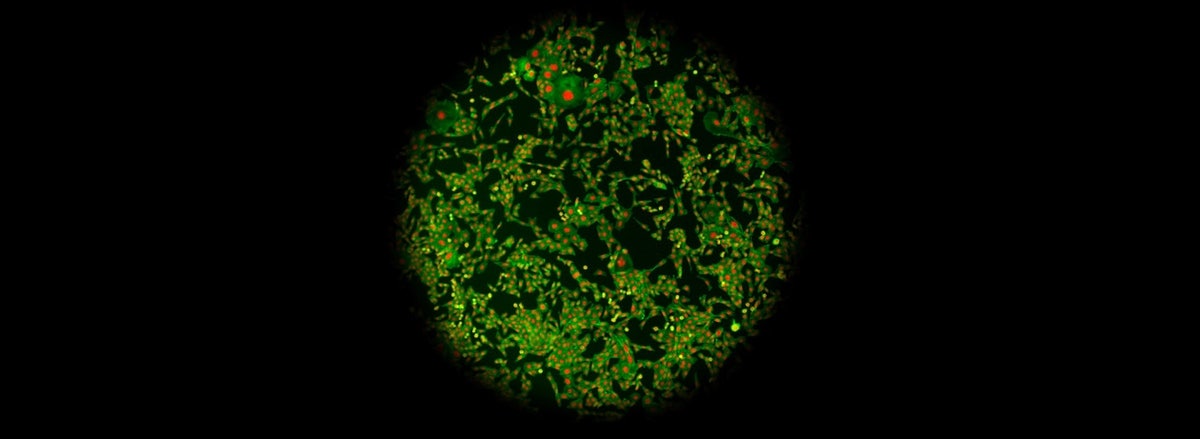 Cellular Image and Analyze | Molecular Devices