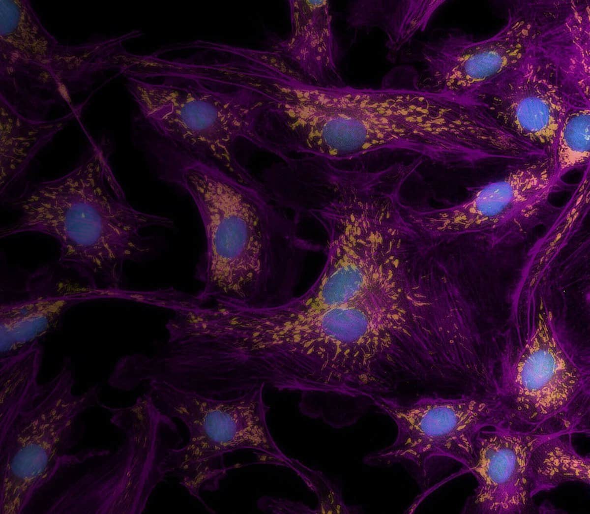 2D and 3D Cellular Models: High-content Analysis and Phenotypic ...