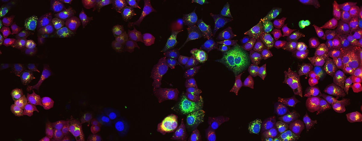 Automated end-to-end Workflows for Complex Organoid Assays