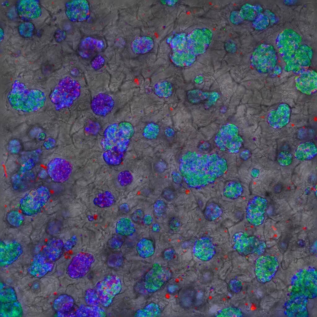 High-content screening tools for 3D in vitro models