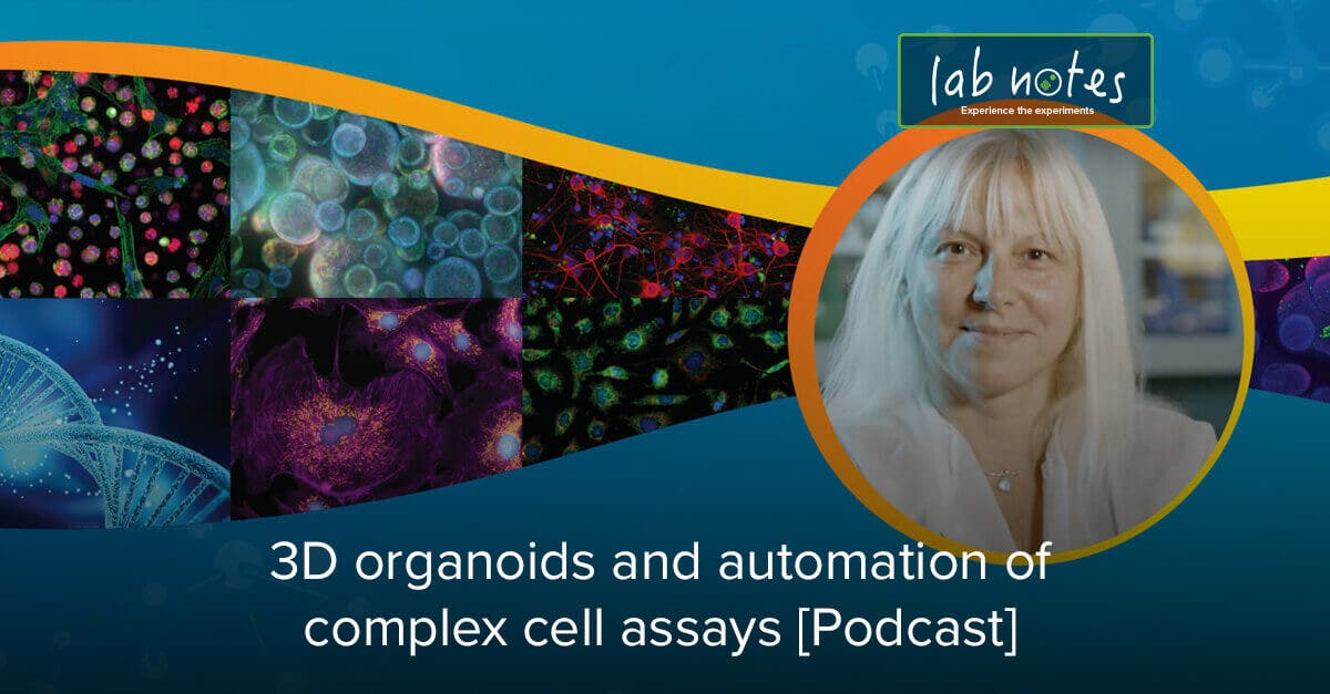 3D organoids and automation of complex cell assays