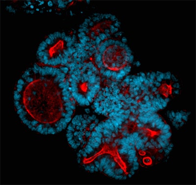 3D Organoids vs 2D Cell Lines in Drug Discovery & Disease Modeling