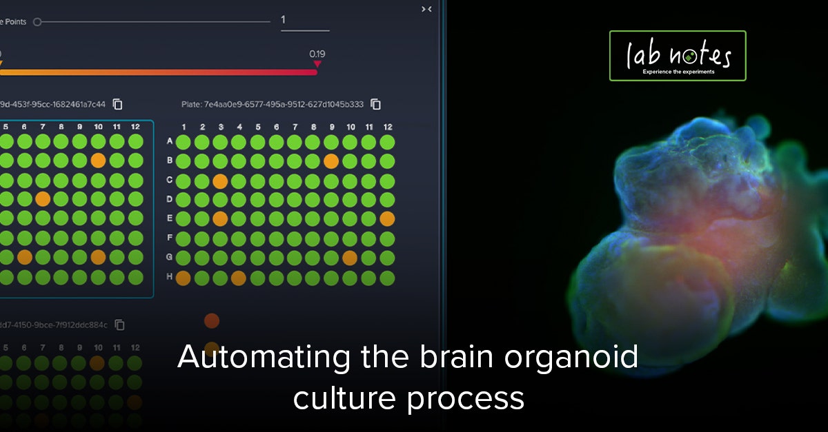 Automating Brain Organoid Culture Process | Molecular Devices