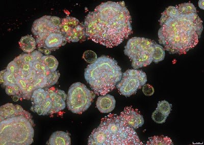 3D Organoids vs 2D Cell Lines in Drug Discovery & Disease Modeling