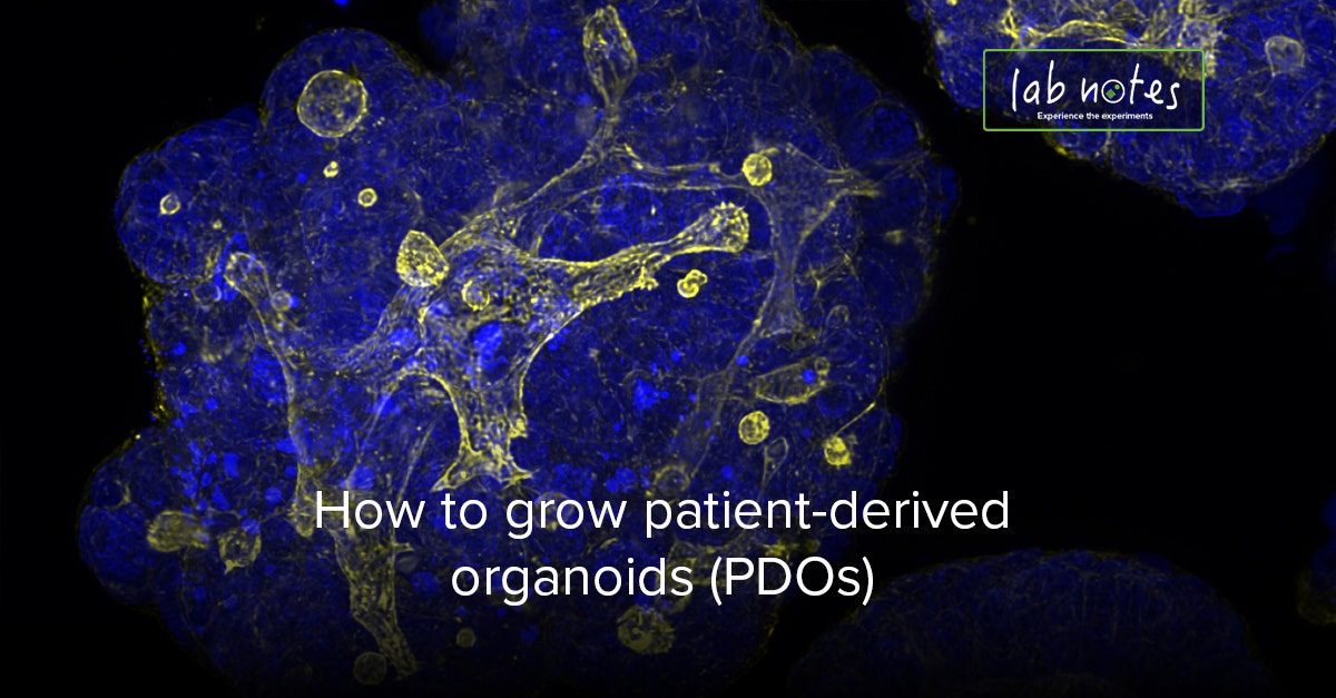 How to grow patient-derived organoids (PDOs)