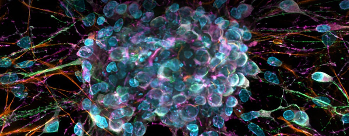 Enhancing 3D Cell Culture Imaging
