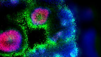 Benefits of Real-Time Live-Cell Imaging