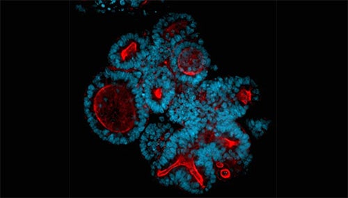 3D Organoids vs 2D Cell Lines in Drug Discovery & Disease Modeling