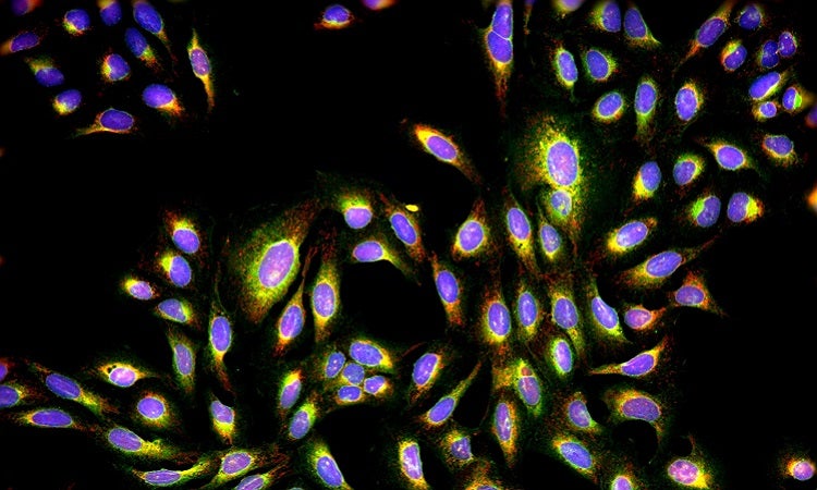Overcoming Analysis Paralysis in Cell Painting With Artificial Intelligence