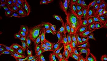 AI-Powered Phenotypic Profiling Revolutionizes Drug Discovery