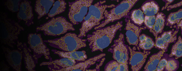 High-content Analysis | HCA