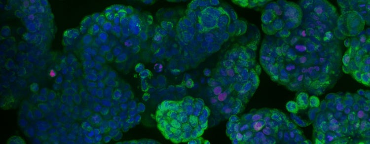 High-content Imaging | HCI Systems