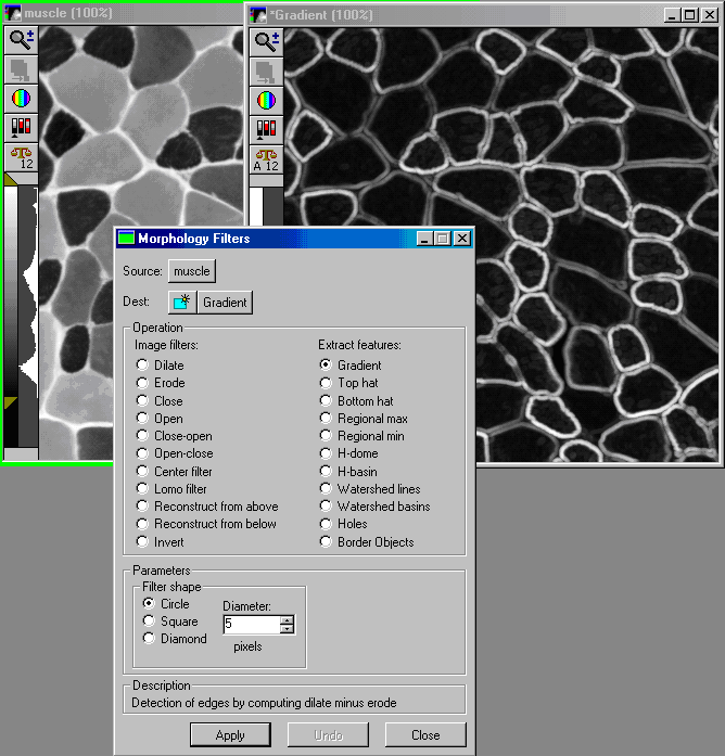 Using the Morphology Filters in the MetaMorph® Software