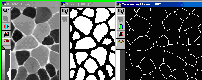Using the Morphology Filters in the MetaMorph® Software