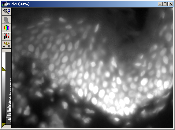 Correcting an uneven background in an image using morphology filters in ...