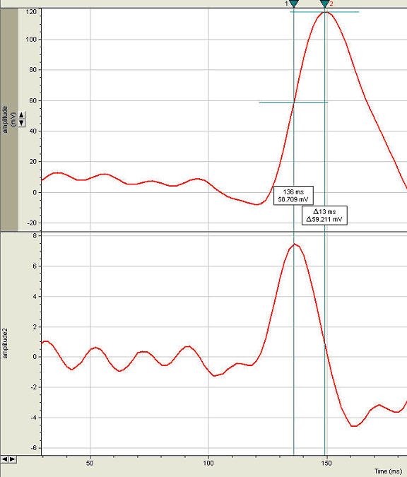 Differentiating Data Traces