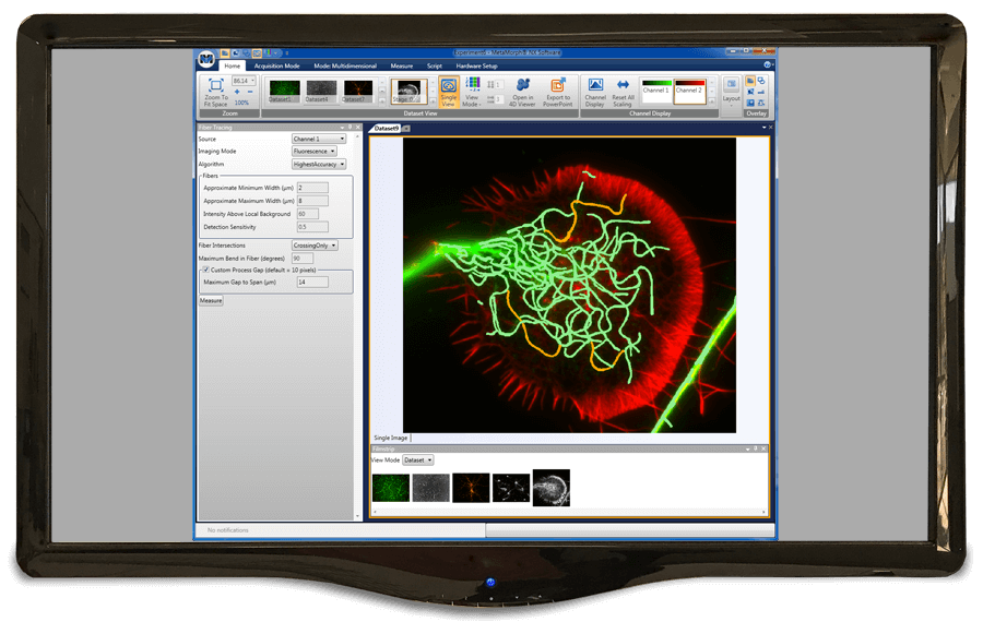 MetaMorph, Microscope Imaging, Microscopy Analysis Software | Molecular ...