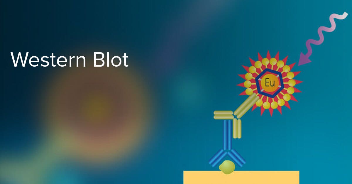 What is Western Blotting, ScanLater Western Blot
