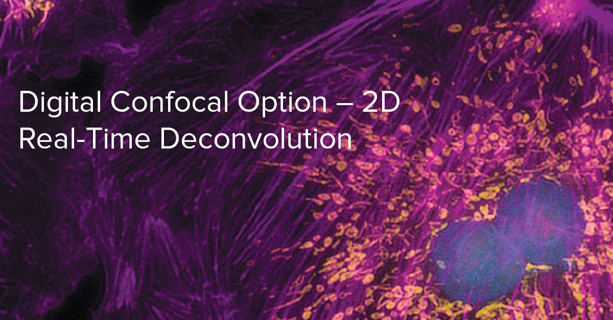 Digital Confocal Option – 2D Real-Time Deconvolution, Widefield Microscopy